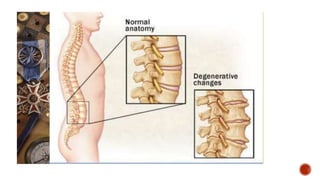 Lumbar plexus plexopathy.pptx