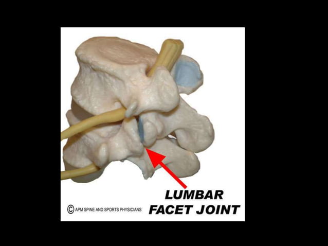 Lumbar spine anatomy | PPTX