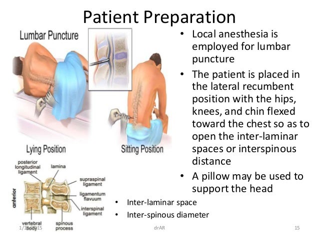 Lumbar puncture