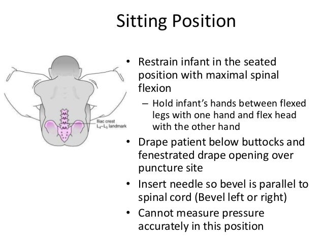 Lumbar puncture