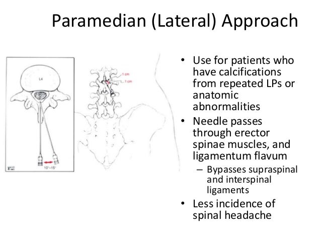 Lumbar puncture