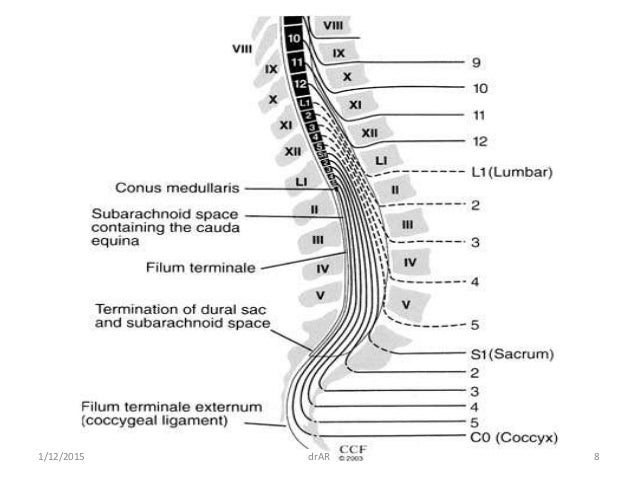 Lumbar puncture