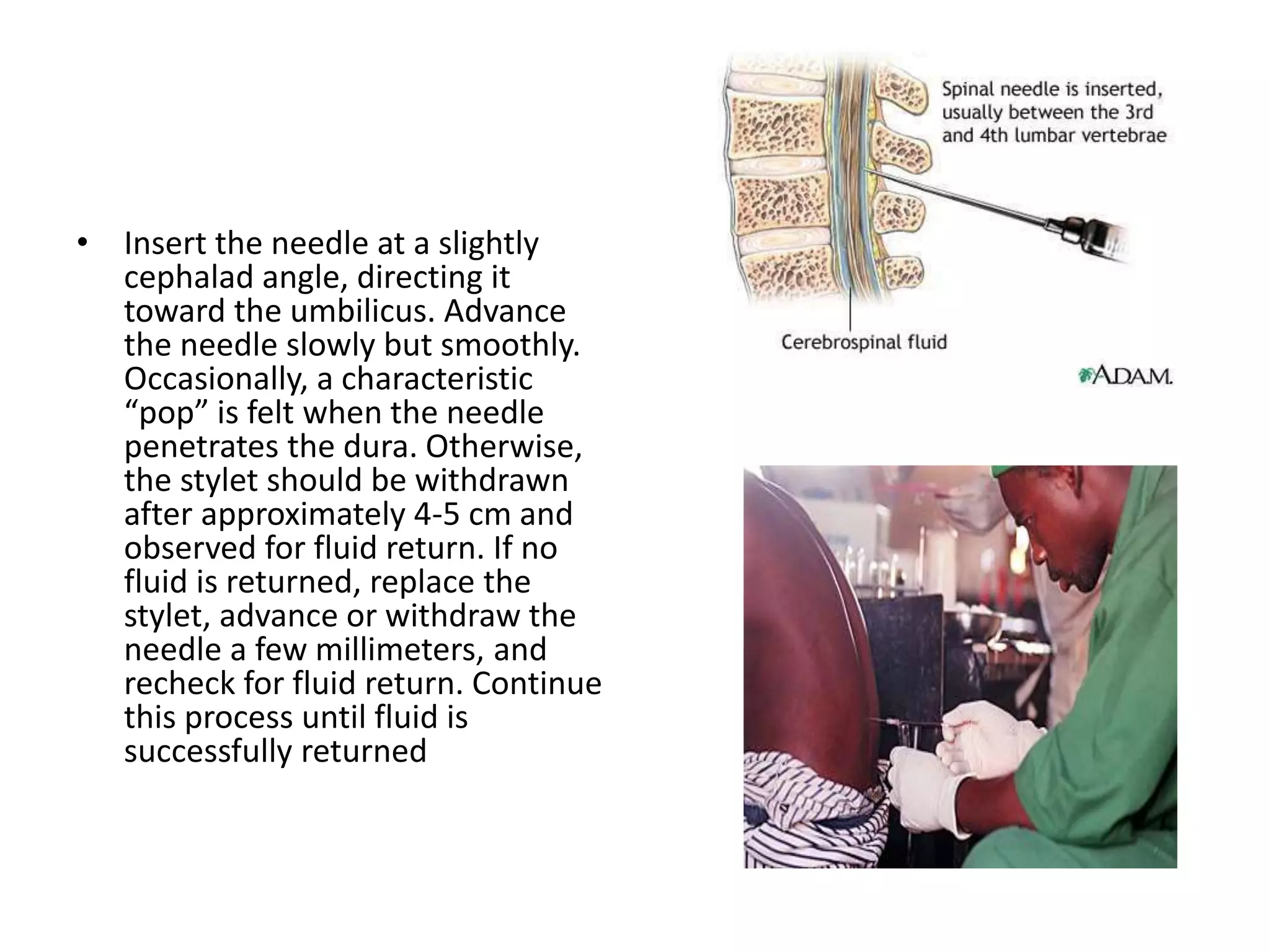 Lumbar puncture | PPTX