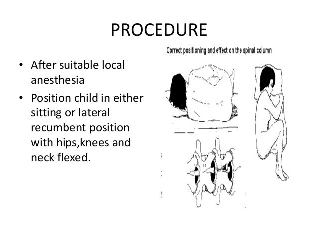 Lumbar puncture
