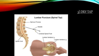 Lumbar puncture | PPTX