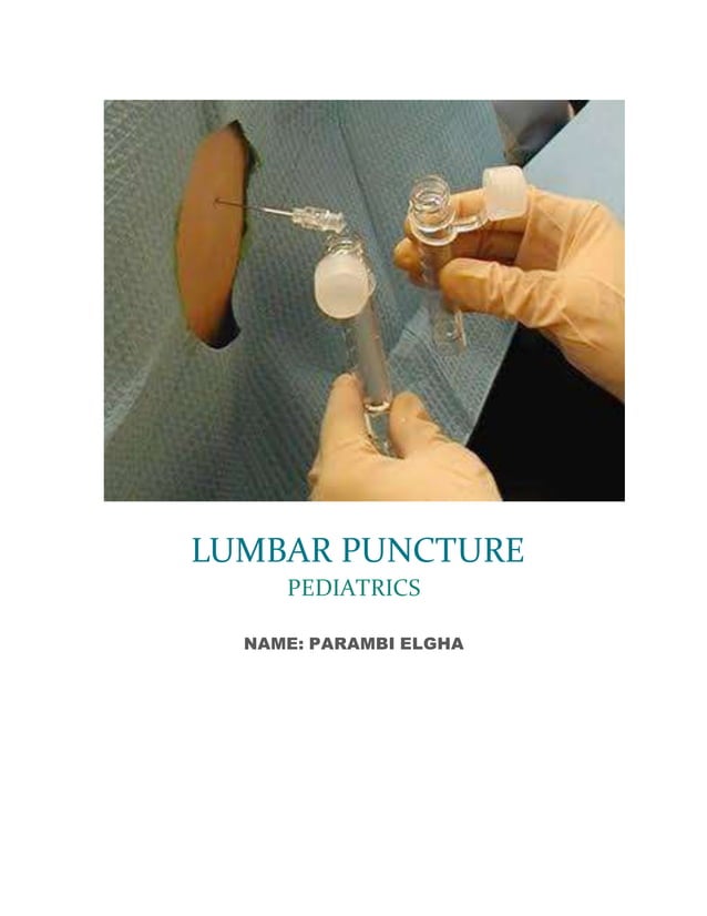 Lumbar puncture | PDF