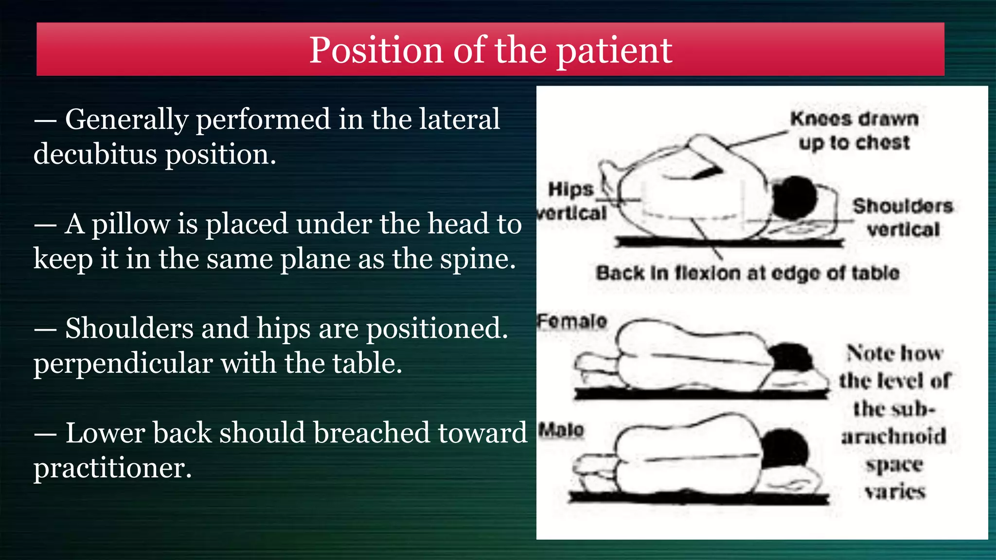 Lumbar puncture - a detailed medical study | all aspects of lumbar ...