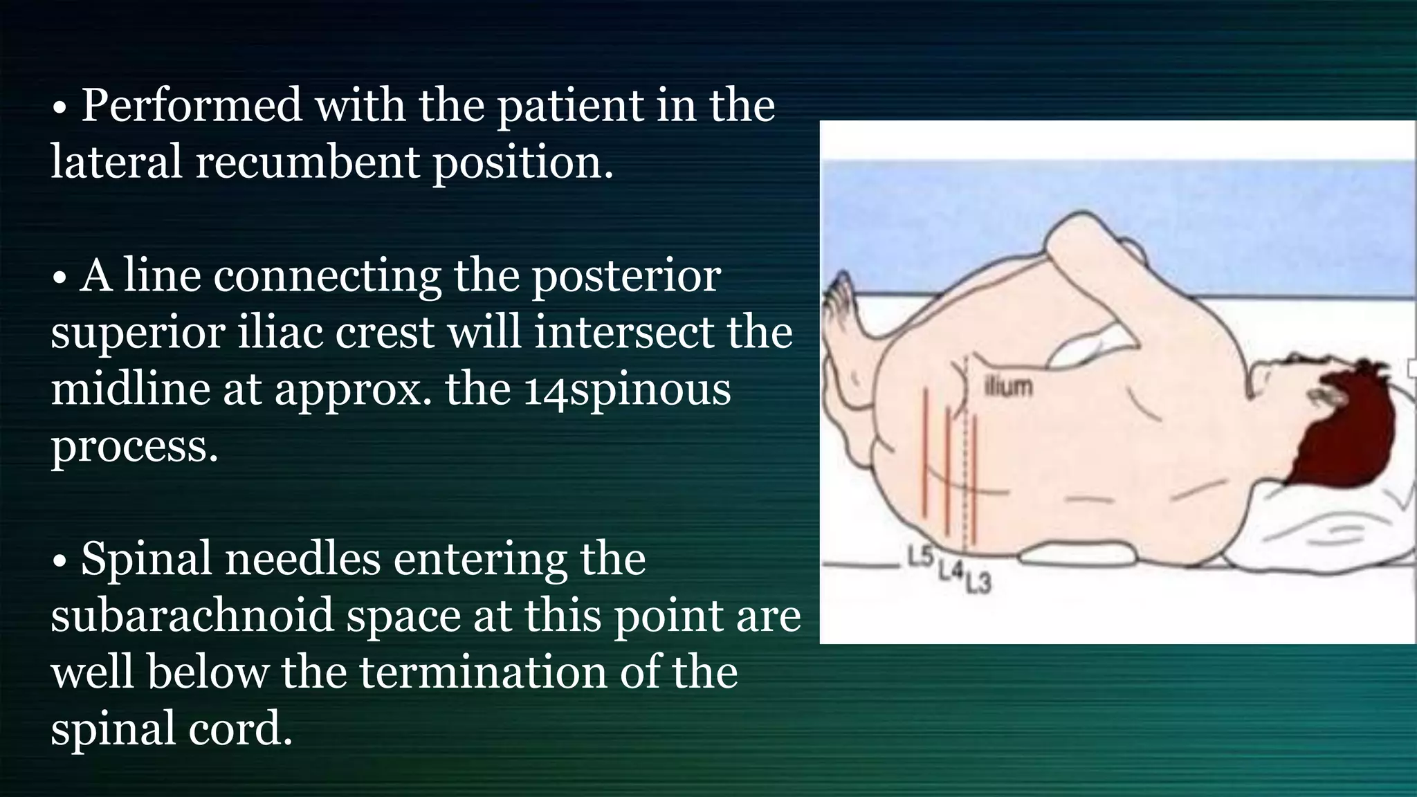 Lumbar puncture - a detailed medical study | all aspects of lumbar ...