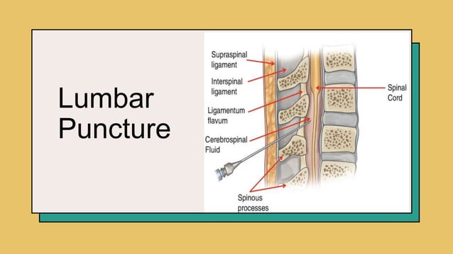 Lumbar Puncture.pptx | First Aid | Injuries