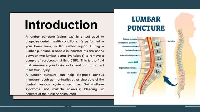 Lumbar Puncture.pptx | First Aid | Injuries