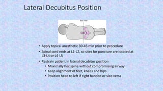 The way of obtaining csf by Lumbar Puncture | PPT