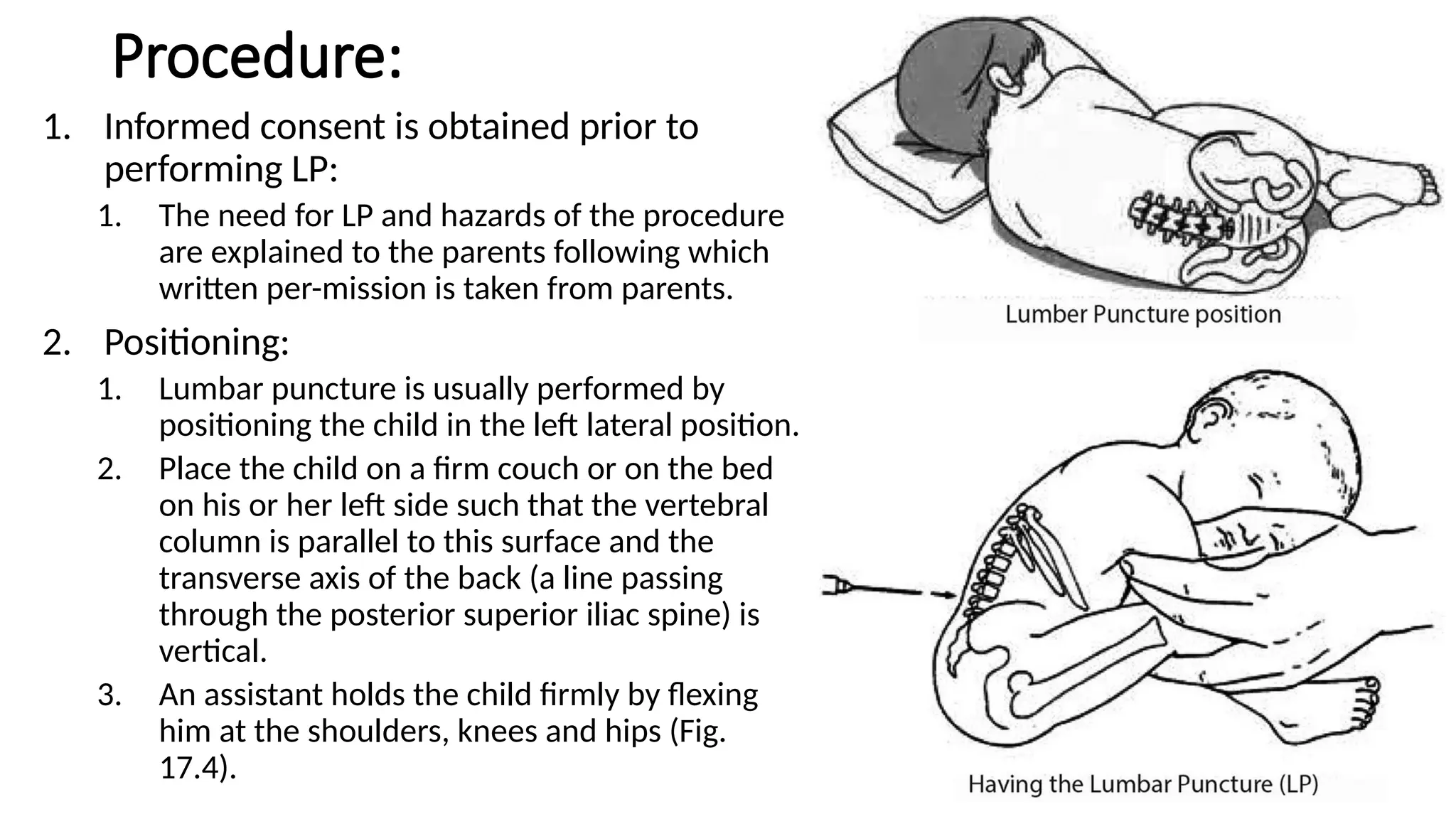 LUMBAR PUNCTURE.in children by dr gavi g patil | PPTX