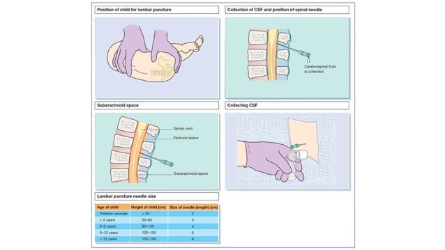 LUMBAR PUNCTURE.in children by dr gavi g patil | PPTX