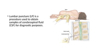 LUMBAR PUNCTURE.in children by dr gavi g patil | PPTX