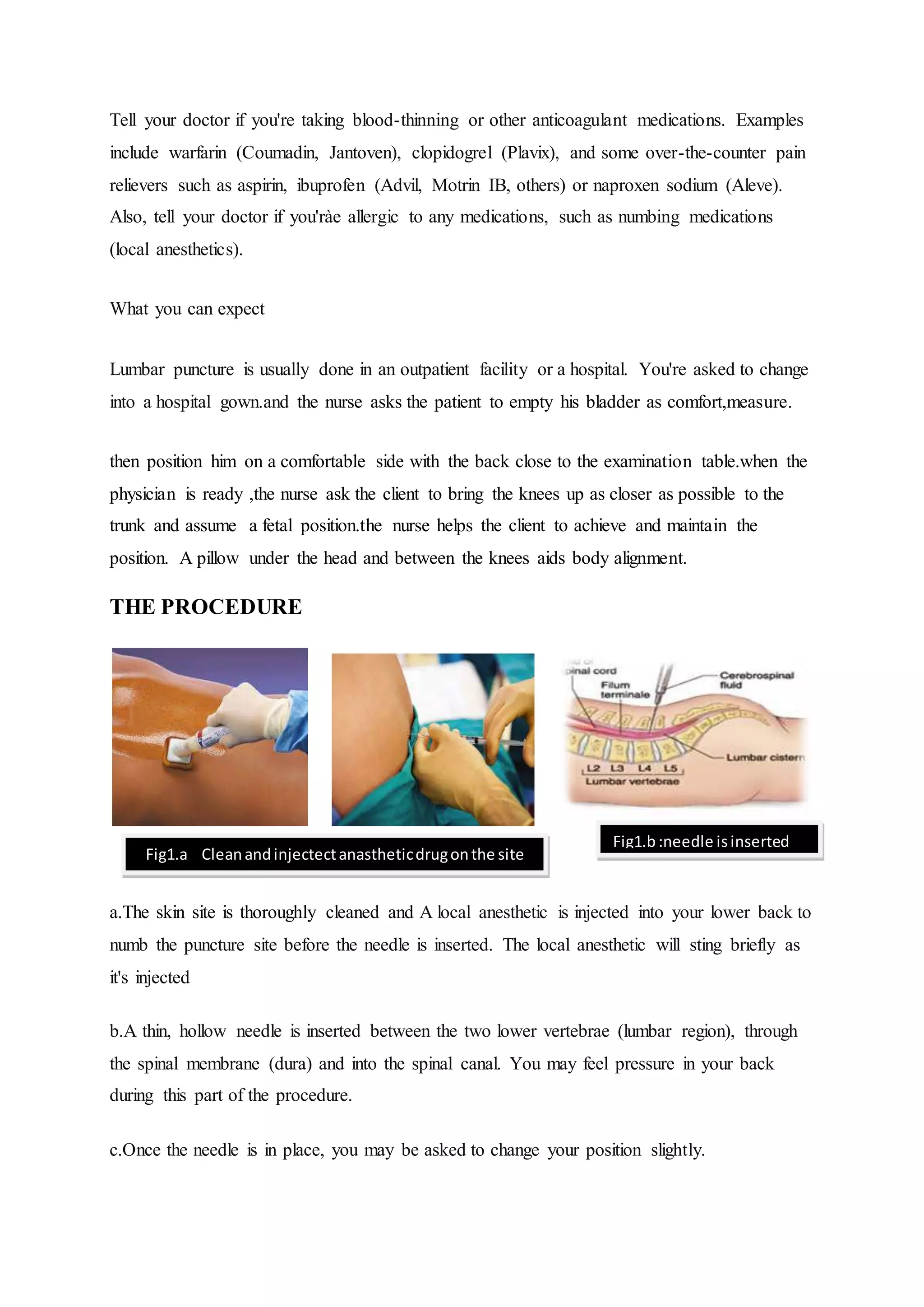 Lumbar puncture | DOCX