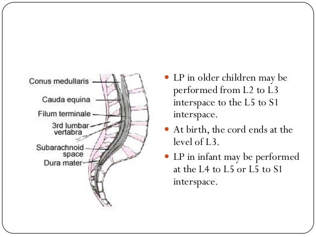 Lumbar puncture and bone marrow aspiration