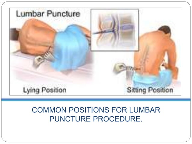 Lumbar Puncture | PPTX | First Aid | Injuries