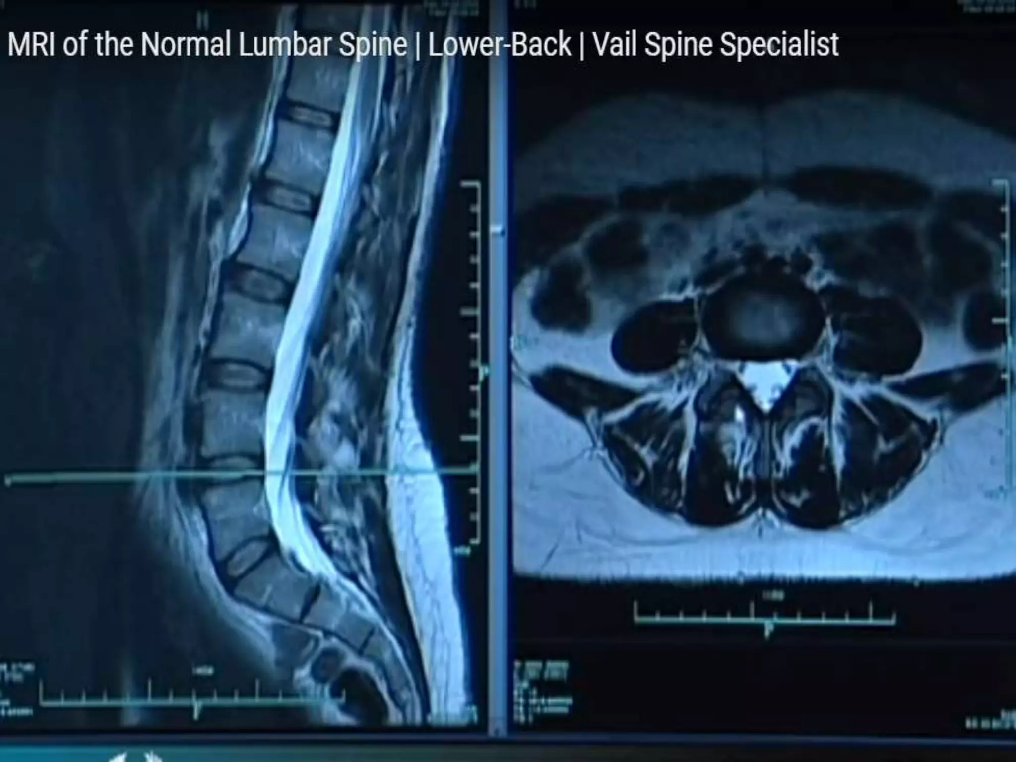 Practical Radiology Of Lumbar spine | PPTX