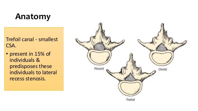 Lumbar spinal stenosis
