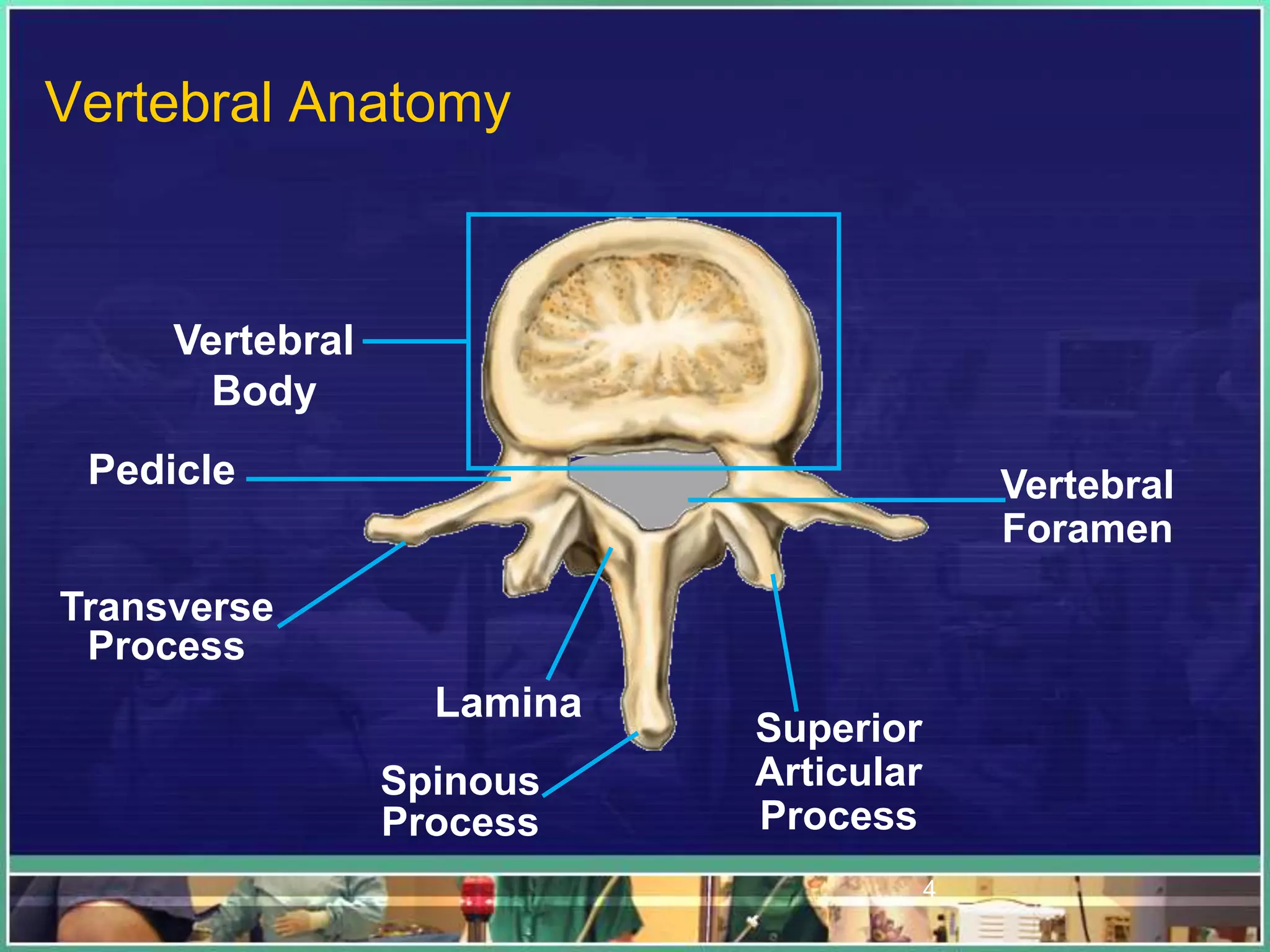 Lumbar spinal stenosis, laminectomy, prolapsed intervertebral disc | PPTX