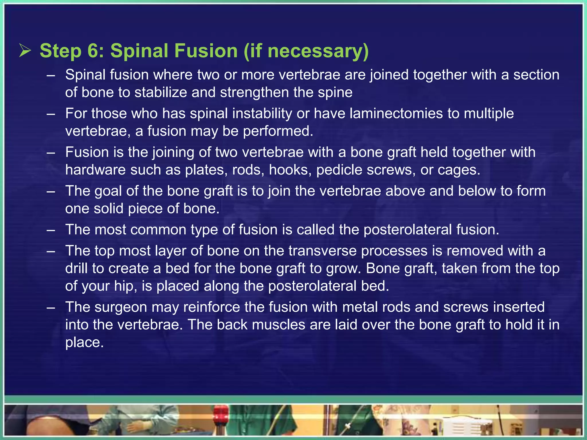 Lumbar spinal stenosis, laminectomy, prolapsed intervertebral disc | PPTX