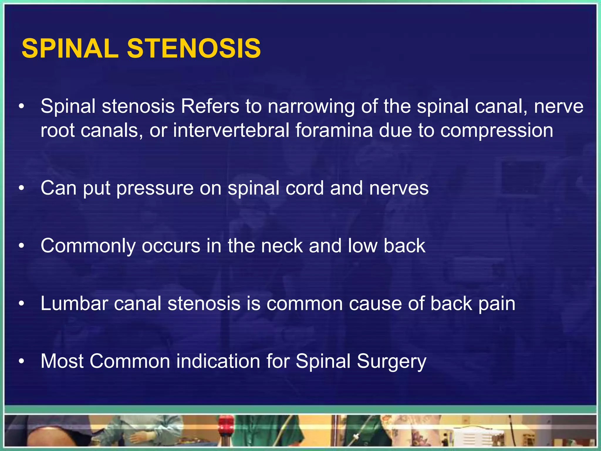 Lumbar spinal stenosis, laminectomy, prolapsed intervertebral disc | PPTX