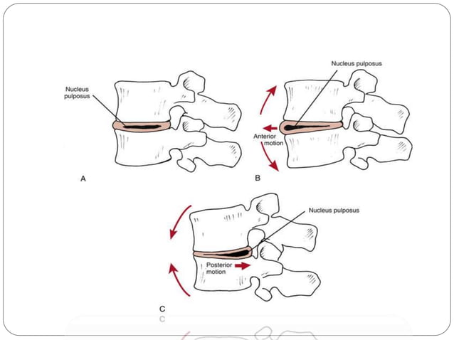 Anatomy and biomechanics of lumbar spine | PPTX | Death, Injury, or ...
