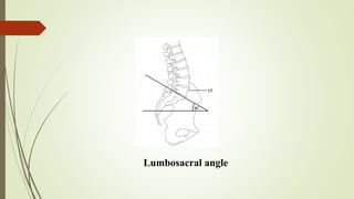 Biomechanics of Lumbar spine | PPTX