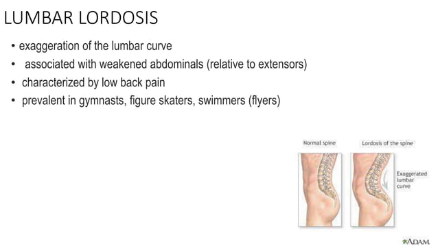 BIOMECHANICS OF LUMBAR SPINE | PPTX