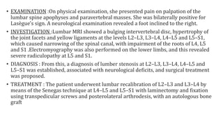 BIOMECHANICS OF LUMBAR SPINE | PPTX