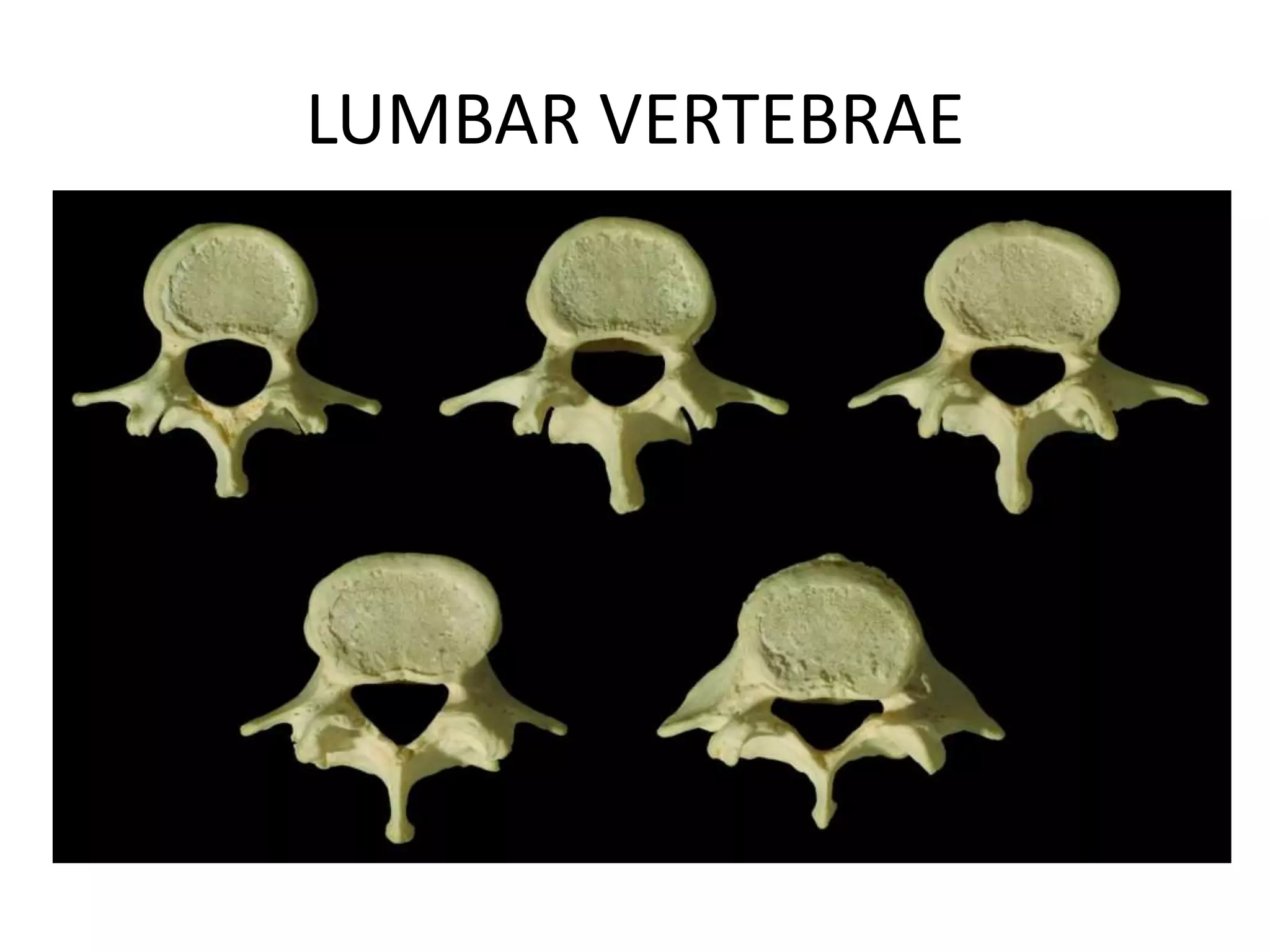 Introduction to Lumbar Spine Mobilisation - Maitland & Mulligan ...