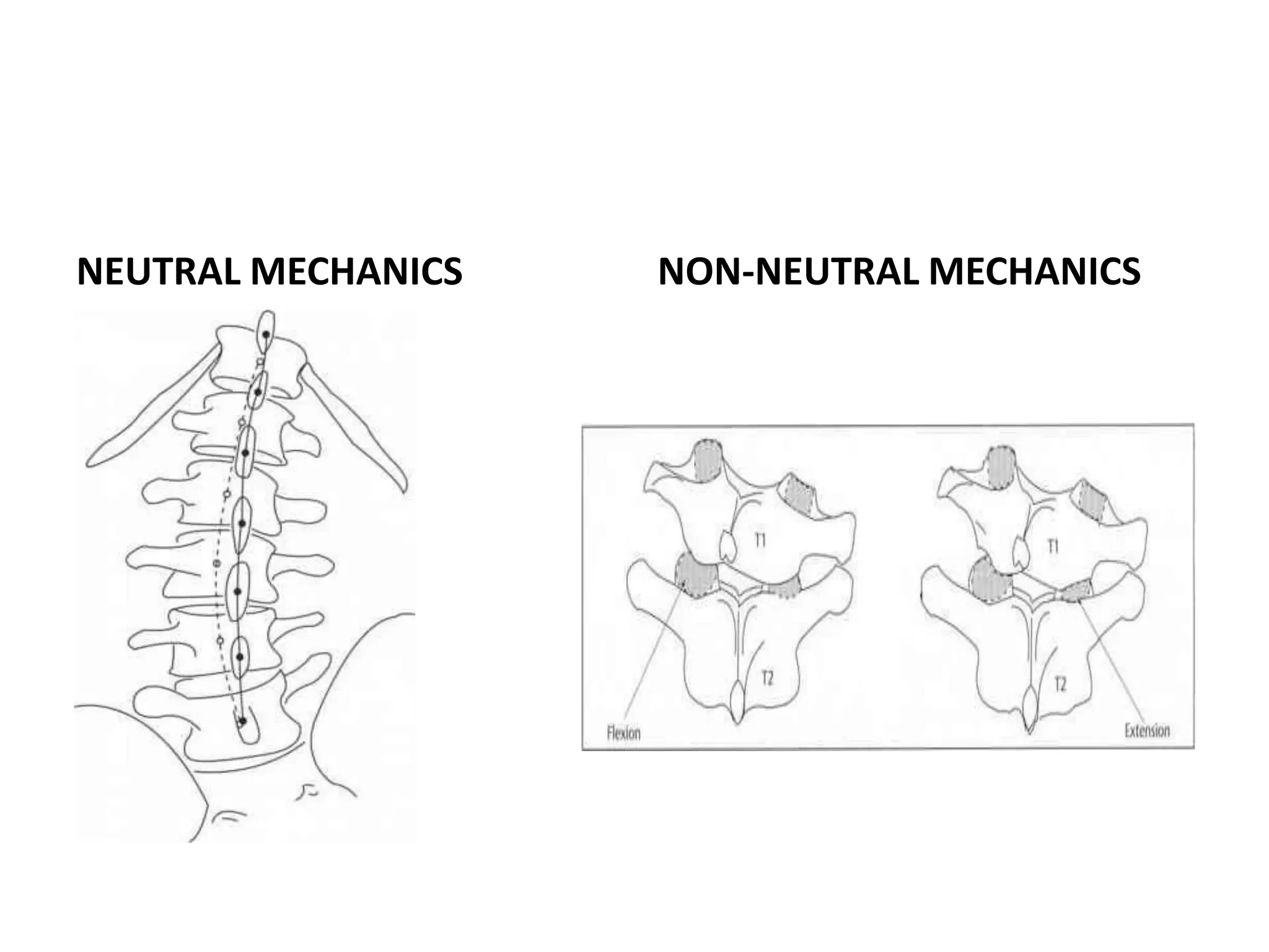Basics of Lumbar spine mobilisation | PPT