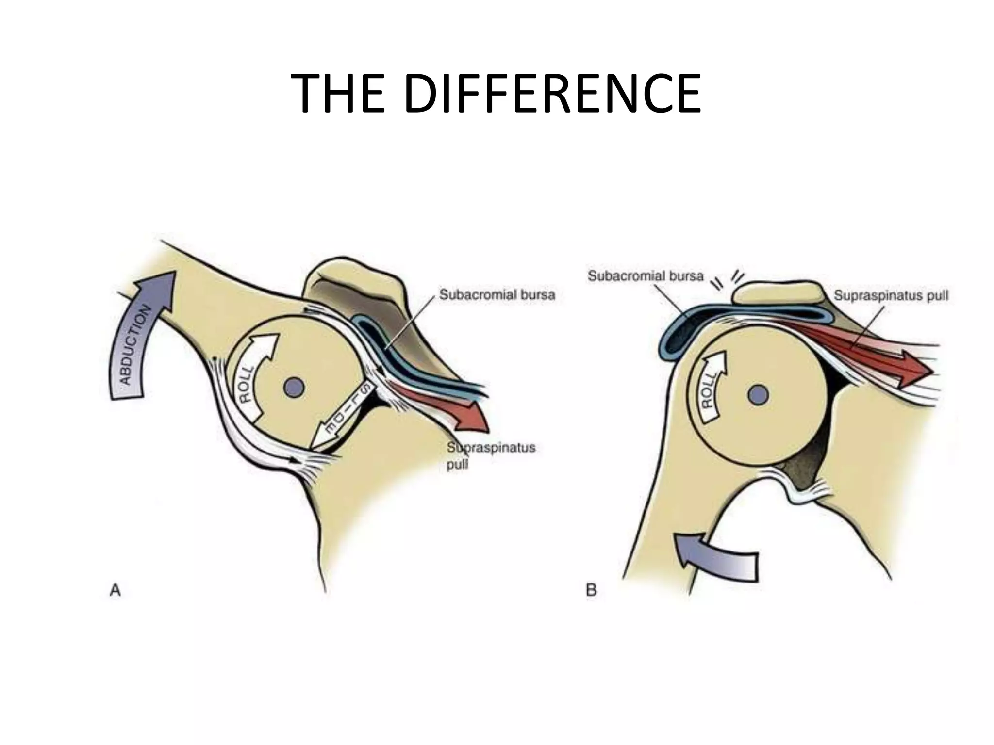 Basics of Lumbar spine mobilisation | PPT