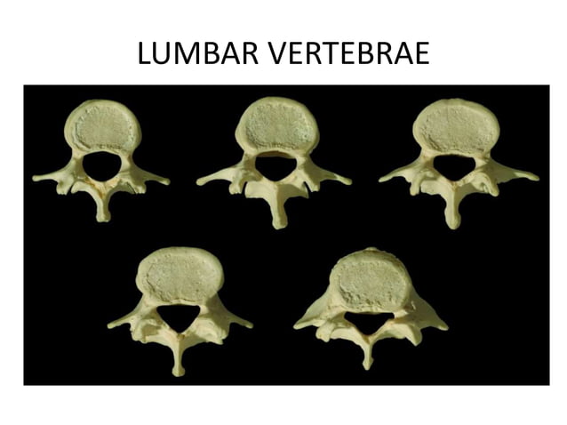 Basics of Lumbar spine mobilisation | PPT