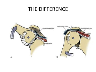 Basics of Lumbar spine mobilisation | PPT
