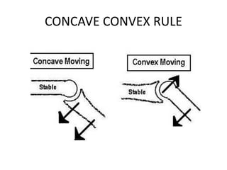 Basics of Lumbar spine mobilisation | PPT