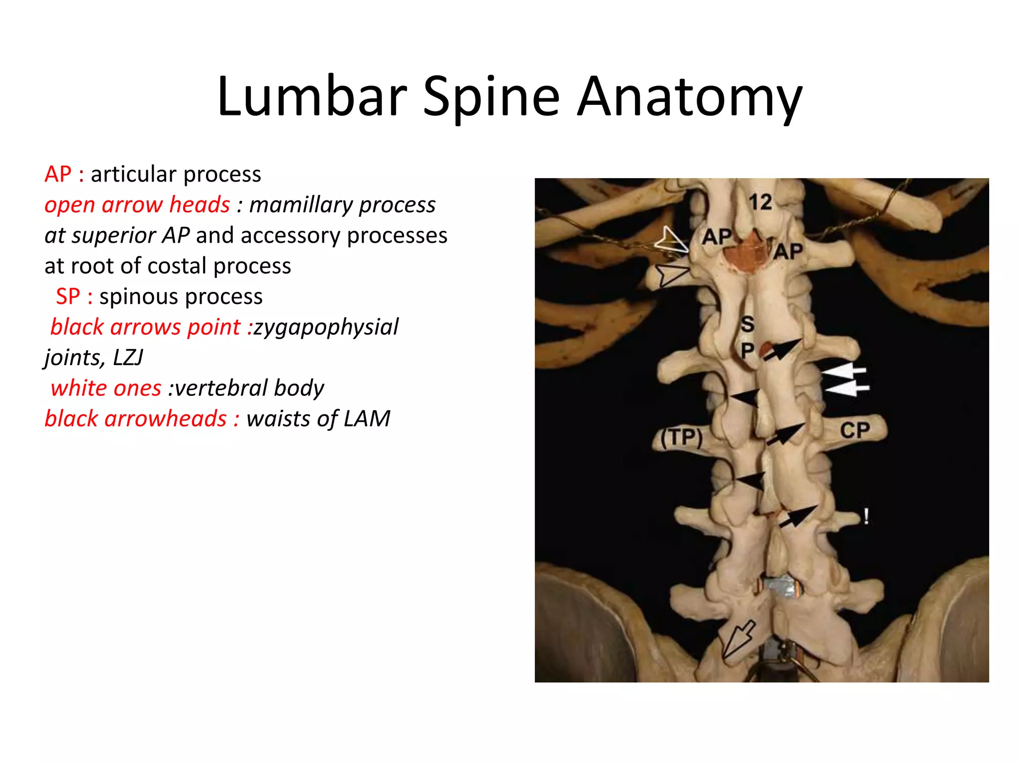 Lumbar spine sonoanatomy | PPTX