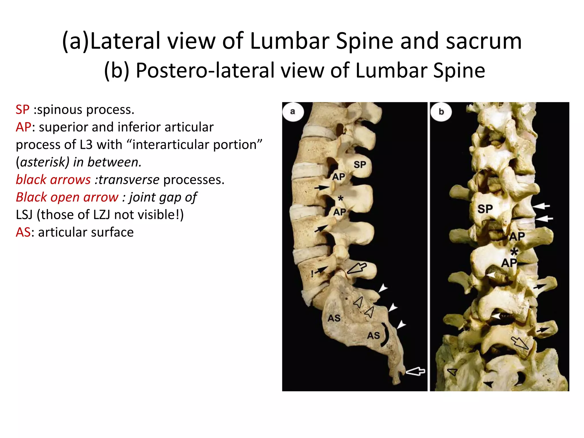 Lumbar spine sonoanatomy | PPTX