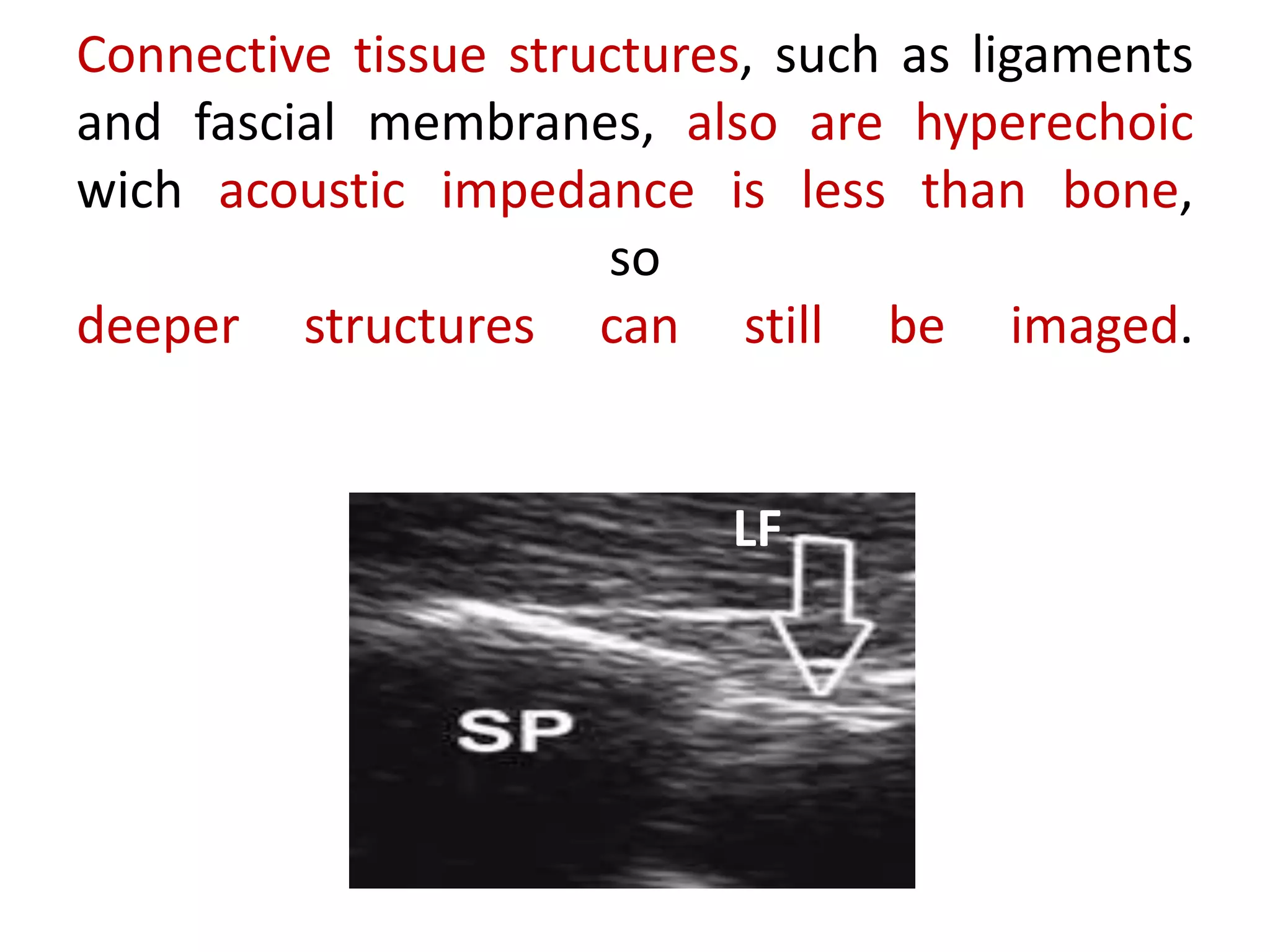 Lumbar spine sonoanatomy | PPTX