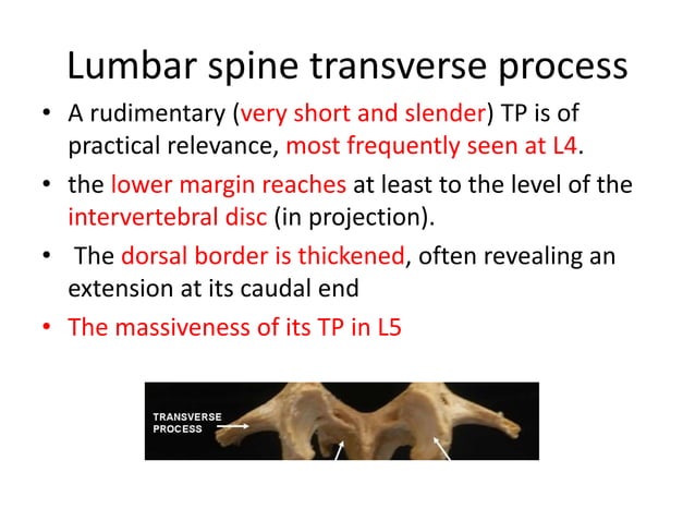 Lumbar spine sonoanatomy | PPTX