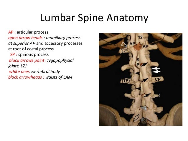 Lumbar spine sonoanatomy