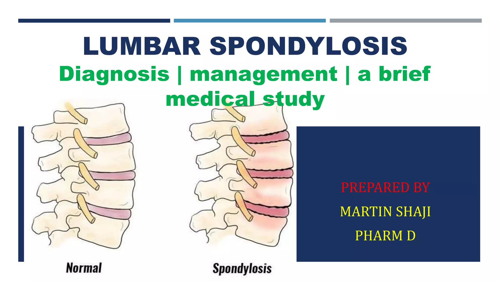 Lumbar spondylosis- Diagnosis | management | a brief medical study | PPTX