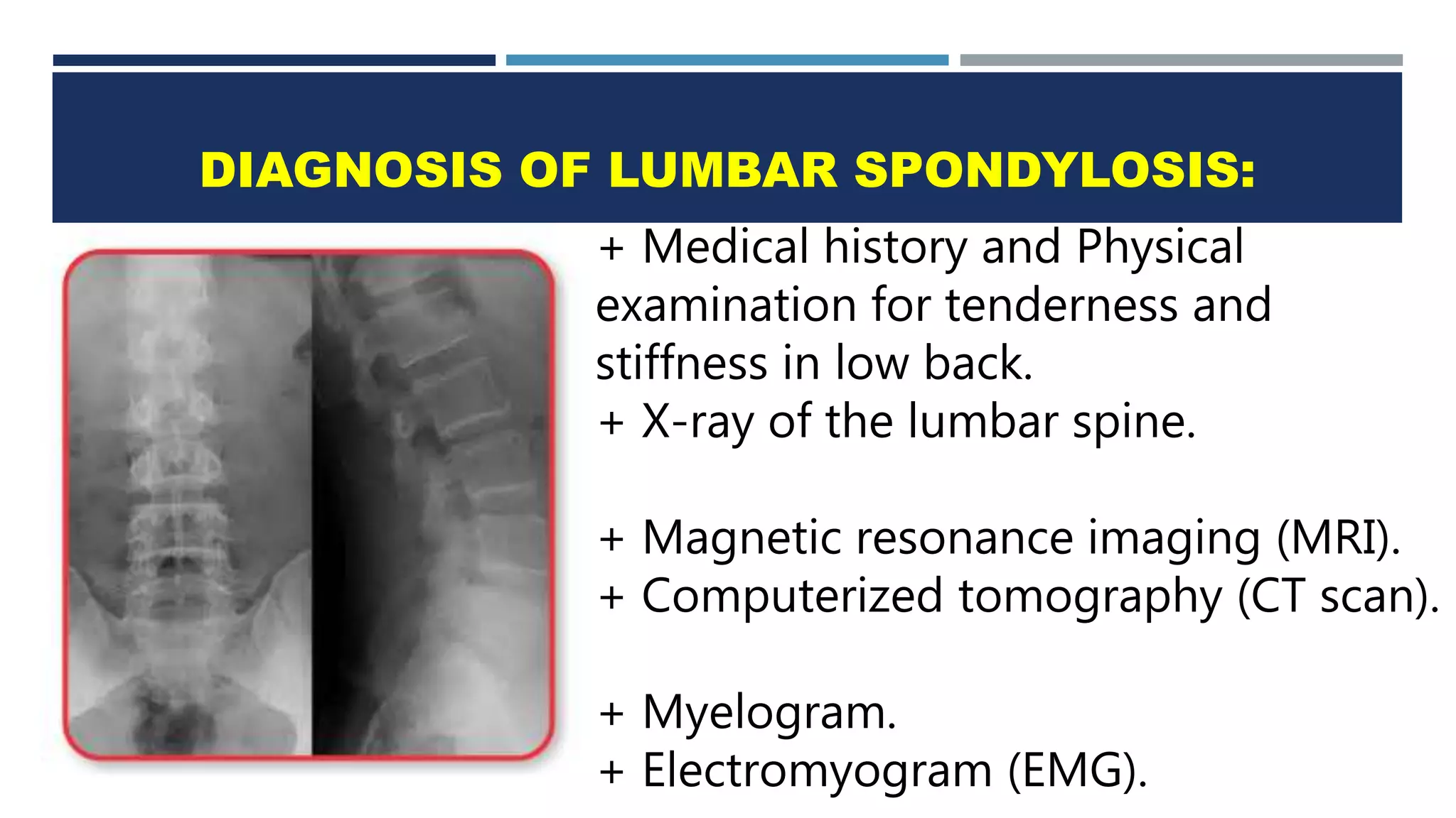 Lumbar spondylosis- Diagnosis | management | a brief medical study | PPTX