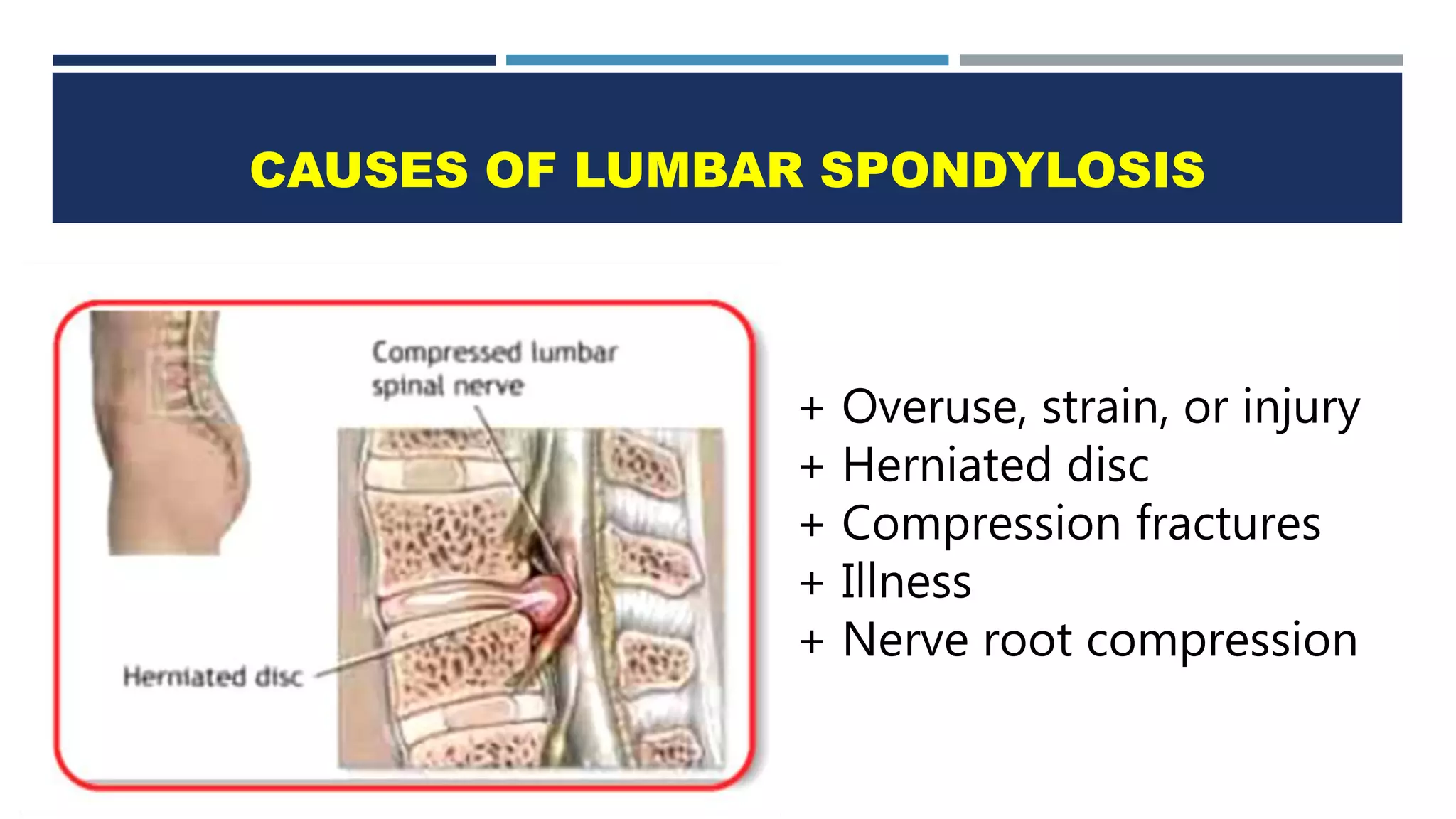 Lumbar spondylosis- Diagnosis | management | a brief medical study | PPTX