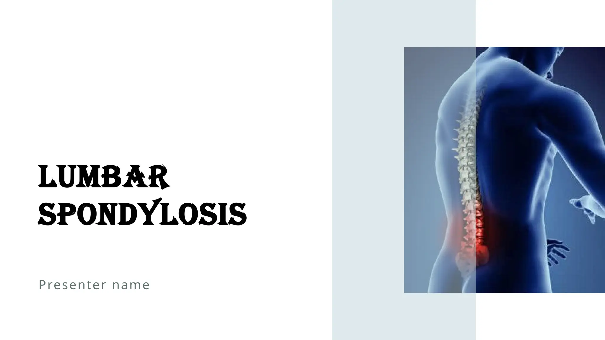 LUMBAR SPONDYLOSIS PARIMAL FINAL.pptx jsjshsh | PPTX | Death, Injury ...