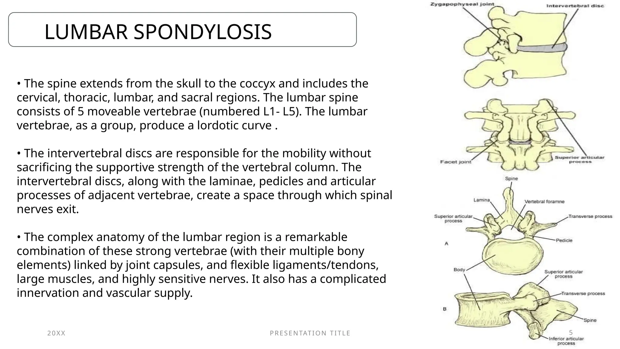 LUMBAR SPONDYLOSIS PARIMAL FINAL.pptx jsjshsh | PPTX | Death, Injury ...