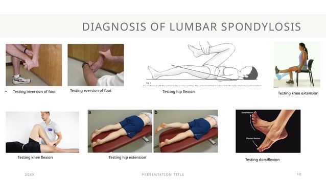 LUMBAR SPONDYLOSIS PARIMAL FINAL.pptx jsjshsh | PPTX | Death, Injury ...