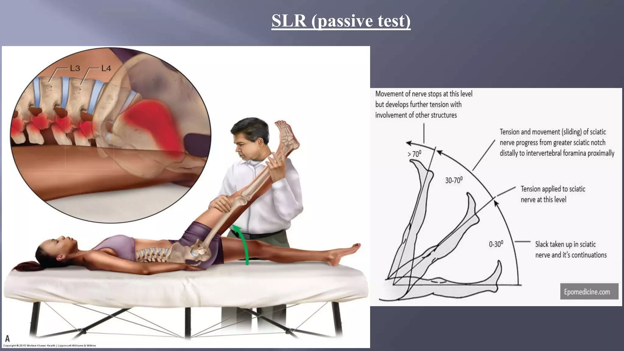 Lumber disc bulge/ Herniation/ Prolapse | PPTX
