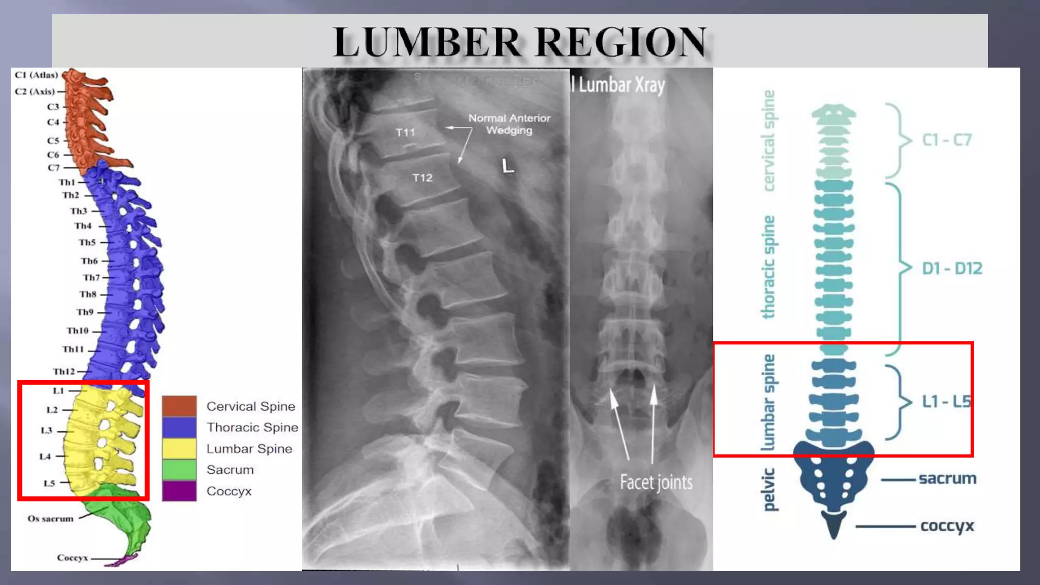 Lumber disc bulge/ Herniation/ Prolapse | PPTX