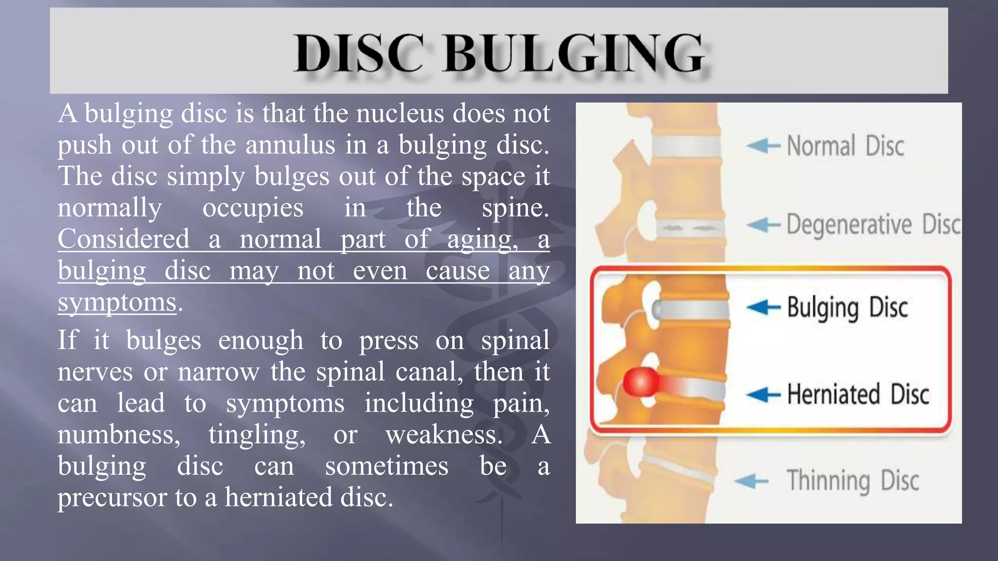 Lumber disc bulge/ Herniation/ Prolapse | PPTX